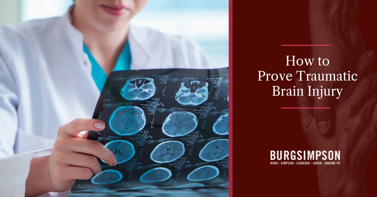 Traumatic Brain Injury Claims: How To Prove Your Case